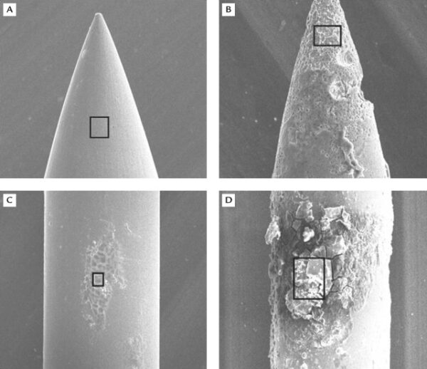 Your One-Stop Guide To Acupuncture Needles - Acupuncture Continuing ...